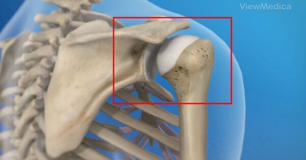Shoulder Anatomy & Pain Treatment | Houston Pain Consultants